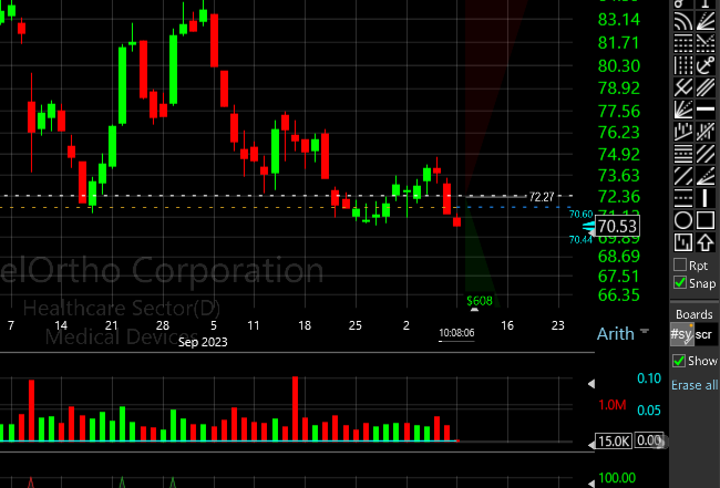 TC2000 Shared Chart Template from Ivan (reactors003)